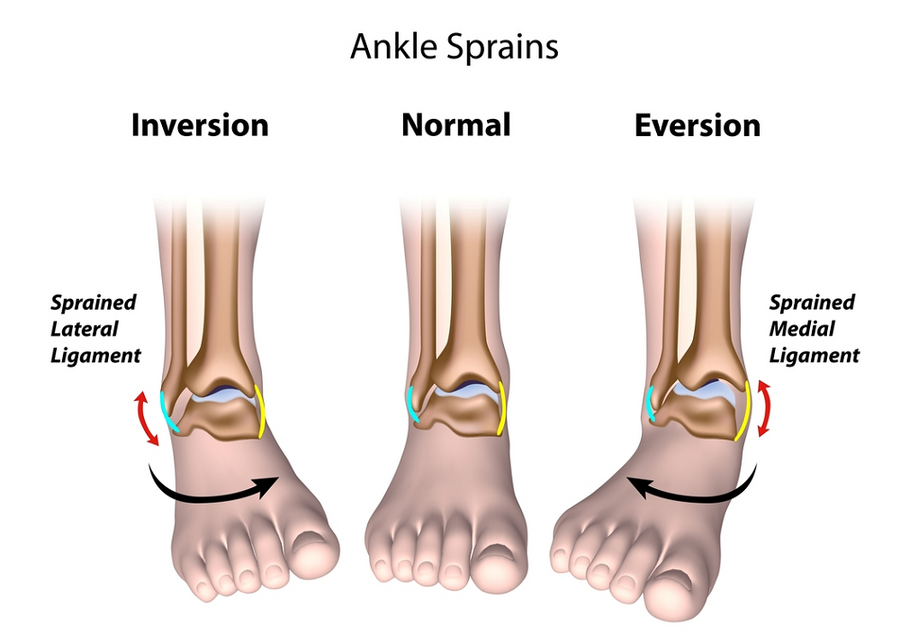 Anatomical Deep Dive: Ankle Joint Eversion and Inversion